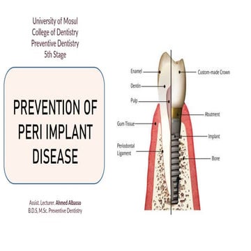prevention of peri implant disease 8.pdf