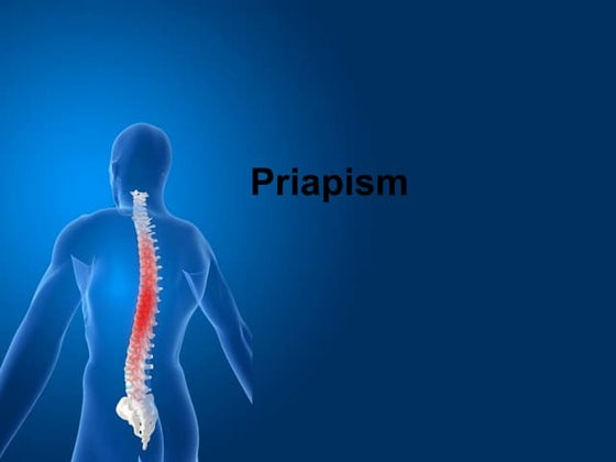 Priaprism | PPT