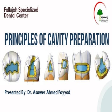 principles of cavity preparation... pptx | PPTX