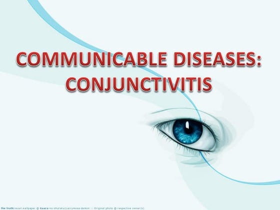 Conjuctivitis | PPTX