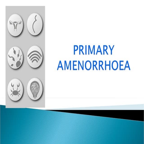 gynaecology.Primary amenorrhea.(dr.sundus) | PPT