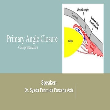Primary angle closure | PPT