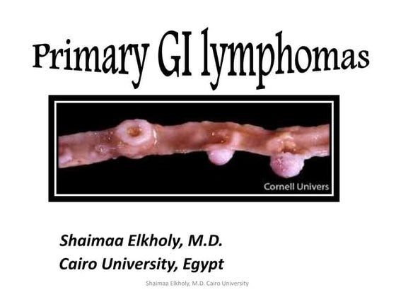 Gastric maltoma | PPT