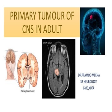 PRIMARY TUMOUR OF CNS IN ADULT | PPTX