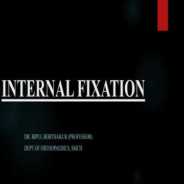 Principle of internal fixation | PPTX
