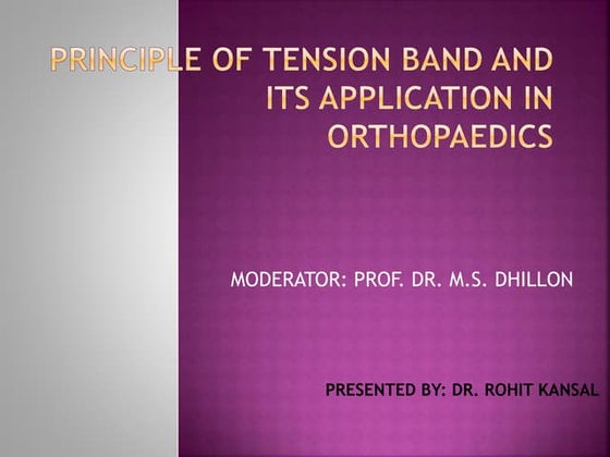 Tension Band Wiring principles and applications | PPT