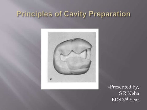 Class II cavity preparation | PPTX | Dental Health | Diseases and ...