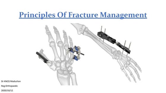fracturemanagement-w-100423032635-phpapp01 (1).pptx