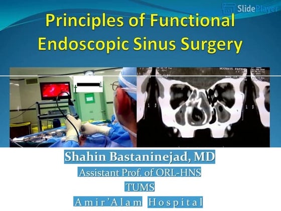 Beautiful.ai - Endoscopic Septoplasty - Slide 1.pptx