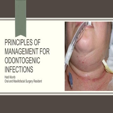 Principles of Management of Odontogenic Infections.pptx
