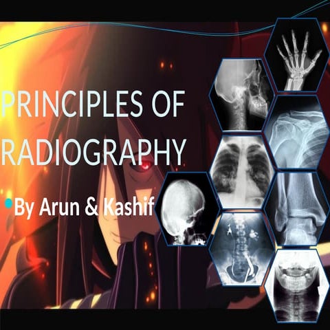 Introduction to radiology | PPTX