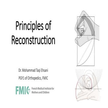 Principles of Reconstructions of Pediatric Hand.pptx