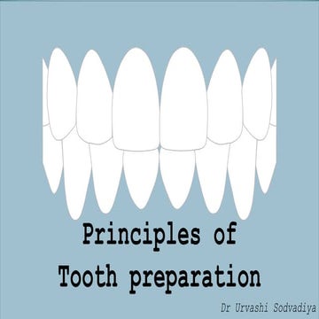 Principles of tooth preparation | PPTX