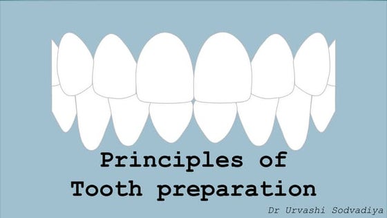 Chipping Fracture Resistance Of Dental CAD-CAM Restorative Materials.pptx