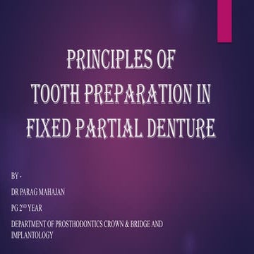 It is principles of tooth prparation.ppt