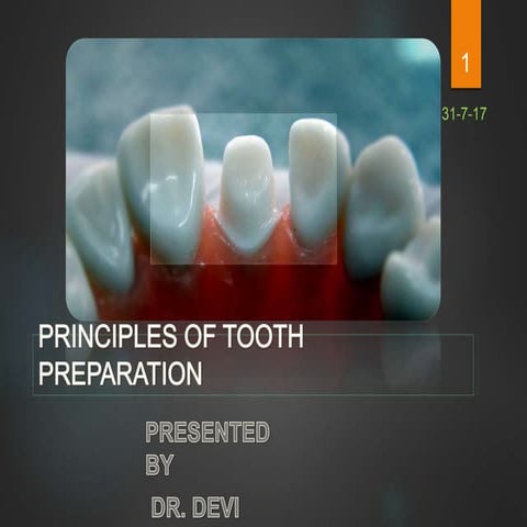 Principles of tooth preparation devi | PPTX