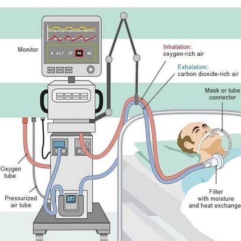 Procedure presentation on Mechanical ventilation | PPTX