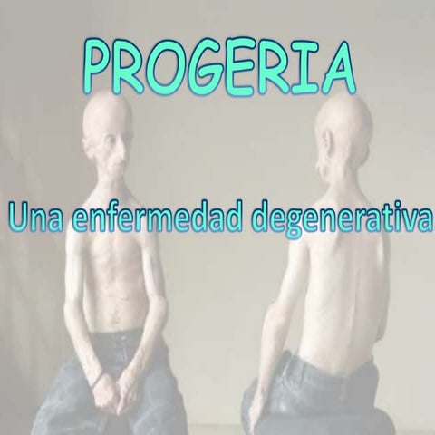 Progeria | PPTX