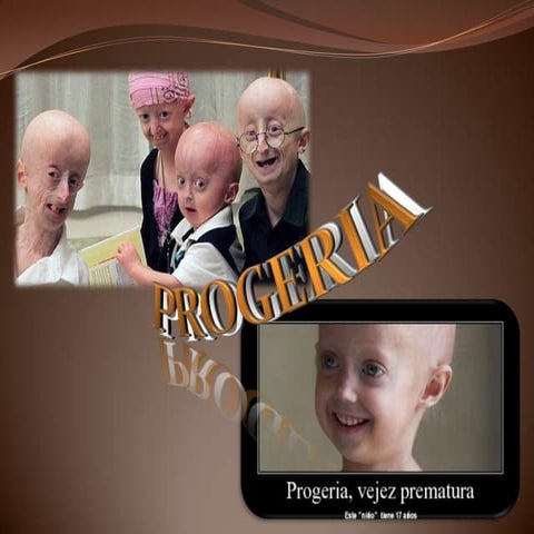 Progeria | PPTX