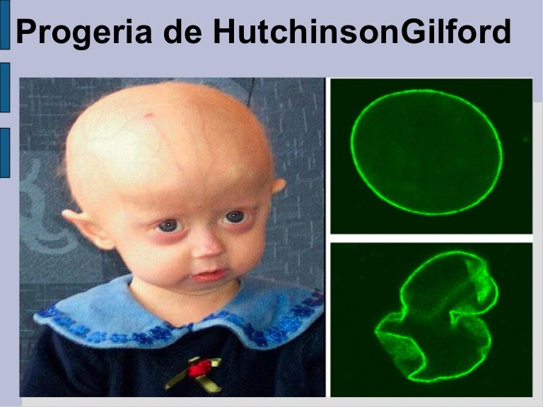 Diagrama De Celulas De Progeria Descubren Microorganismos Capaces De