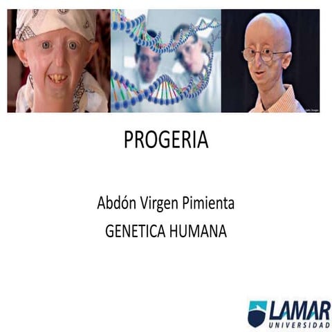 Progeria | PPTX