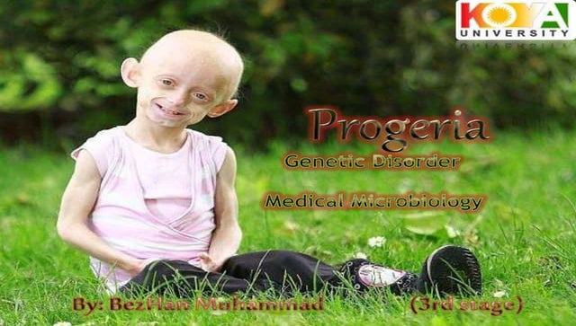 Progeria Research Foundation at Partnering for Cures | PPT