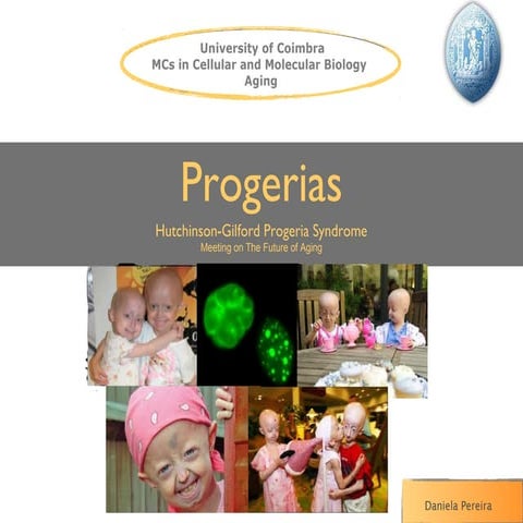 Progeria | PPT