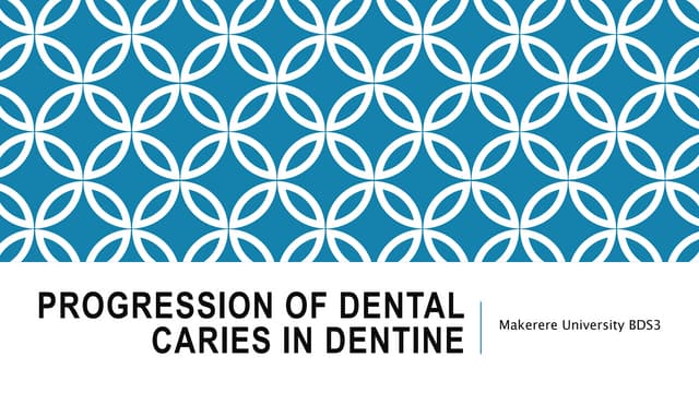 Zones of enamel and dentinal caries completed | PPTX