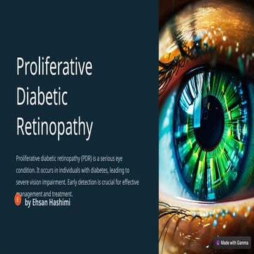 Proliferative-Diabetic-Retinopathyy.pptx