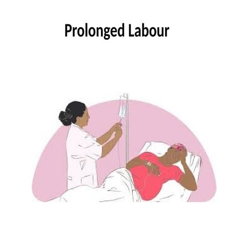 Prolonged Labour.pptxProlonged Labour.pptx