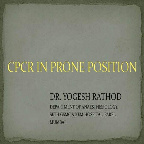 Prone cpcr | PPTX
