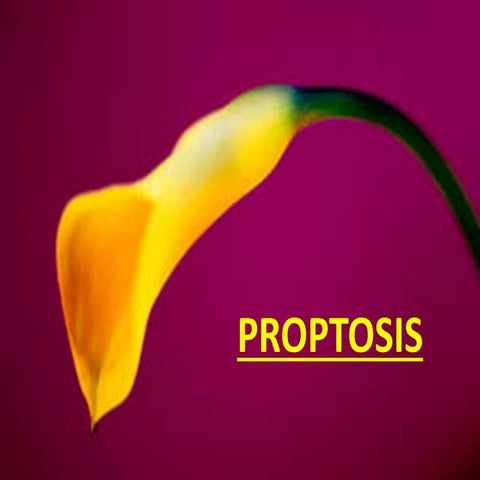 Proptosis in ophthalmology | PPTX