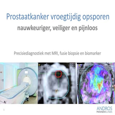Prostaatkanker opsporen met MRI en fusie-biopsie | PPTX