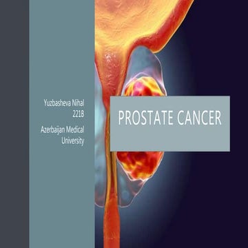 Prostate Cancer (Urology) | PPTX
