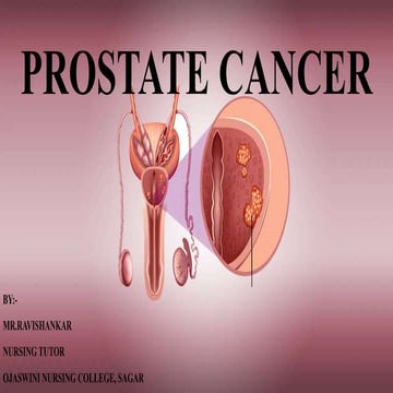 Prostate cancer.pptx