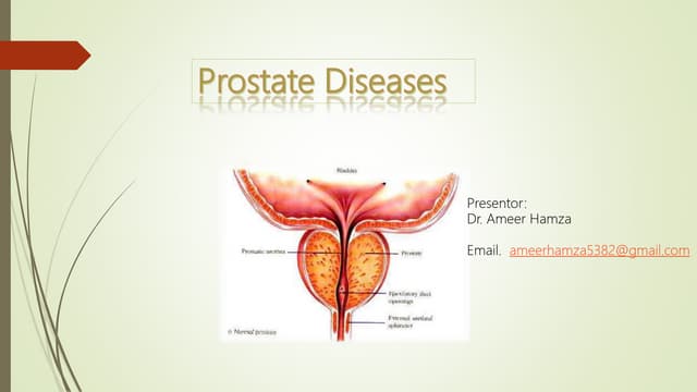 Prostate Cancer Cause Defined Symptom Risk Factors Ppt