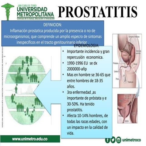 Prostatitis | PPTX