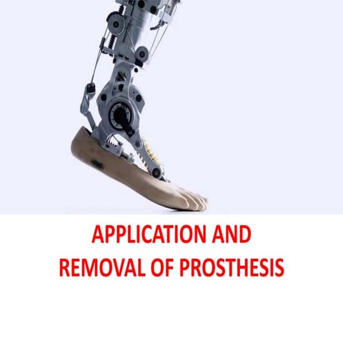 Prosthesis | PPTX | Foot Health | Diseases and Conditions