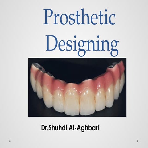 Prosthetic Designing (2).pptx............ | PPTX