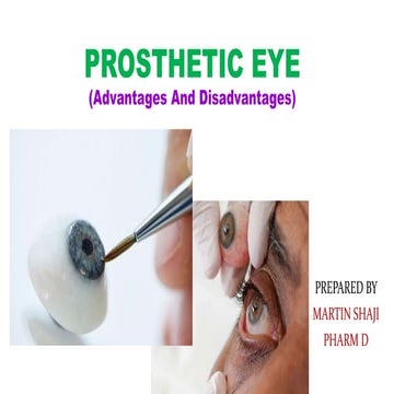 Prosthetic eye( advantages & disadvantages)- in brief | PPTX | Eye and ...