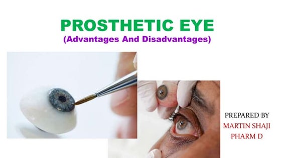 eye prosthesis and rehabilitation.pdf