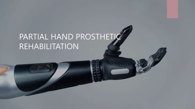 Myoelectric prosthesis | PPTX