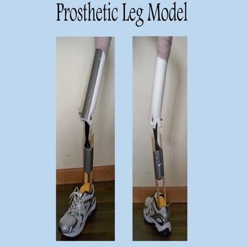 Prosthetic leg model | PPTX