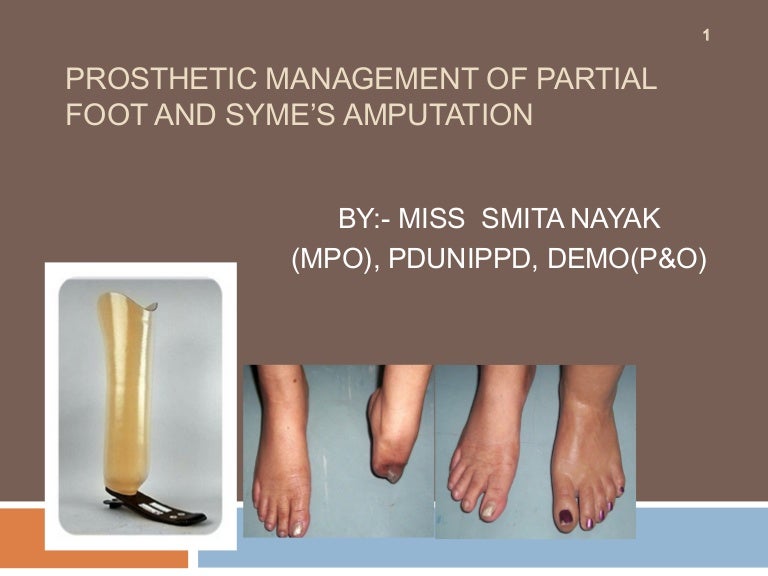 Prosthetic management of symes and partial foot amputation