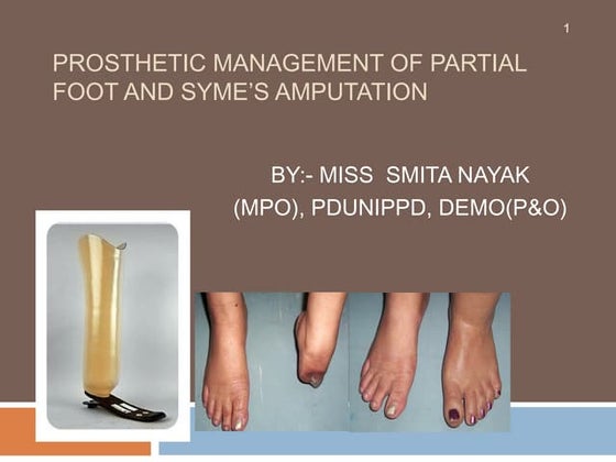 Biomechanics of Quadrilateral socket | PPTX
