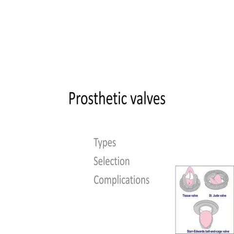 Prosthetic valves-.ppsx
