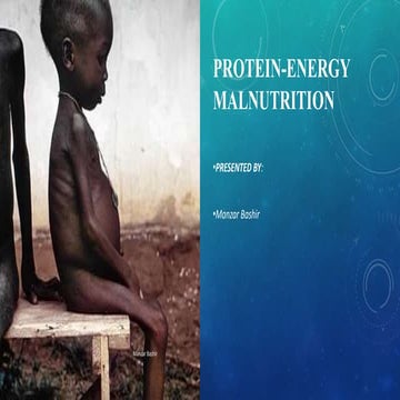 Malnutrition | PDF