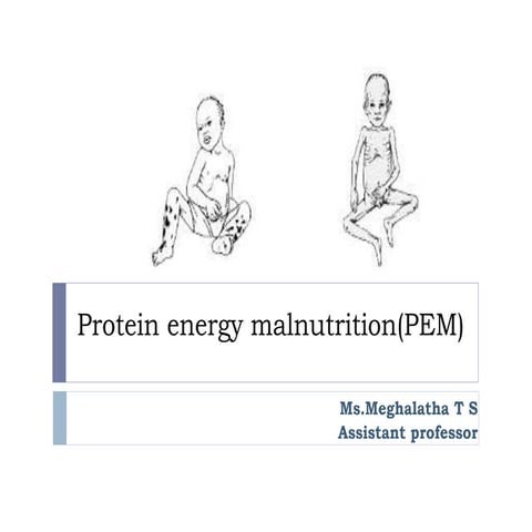 Protein energy malnutrition(PEM) | PPTX | Nutrition | Healthy Living