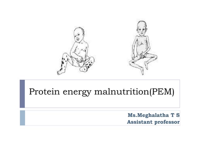 Protein Energy Malnutrition | PPTX