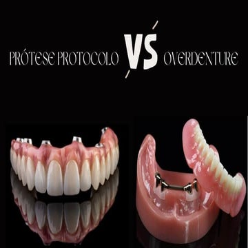 Protese Protocolo Overdenture.pdf